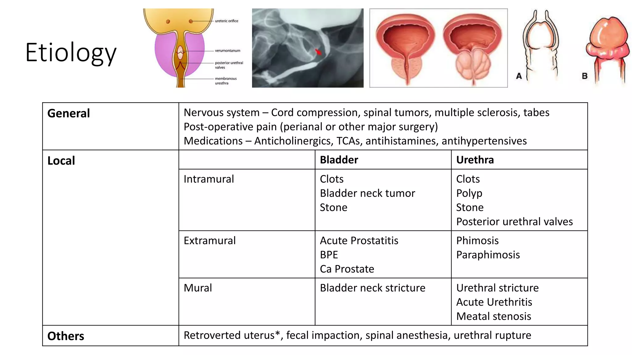 Urine retention MB6.pptx