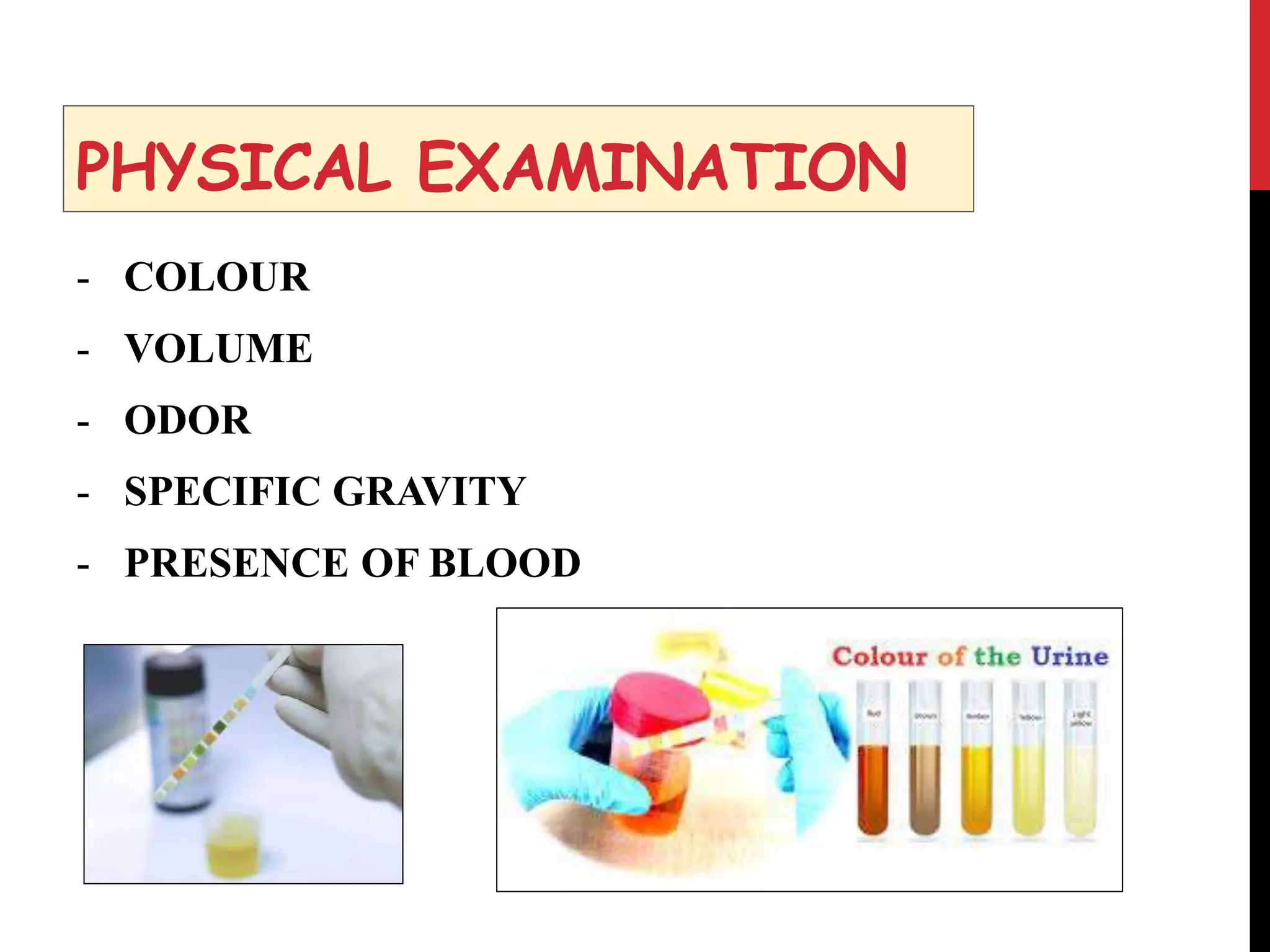URINE SAMPLE processing.pptx