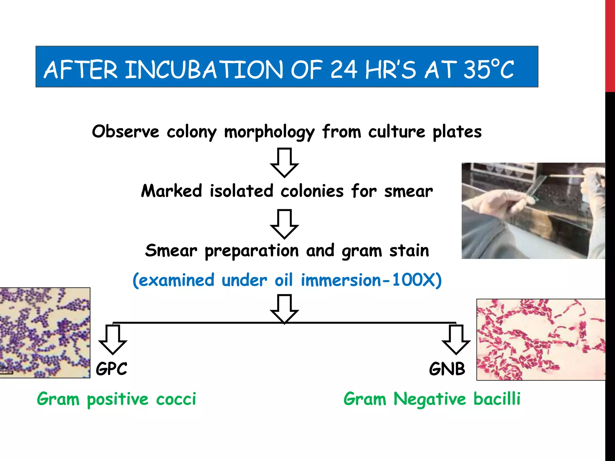 URINE SAMPLE processing.pptx