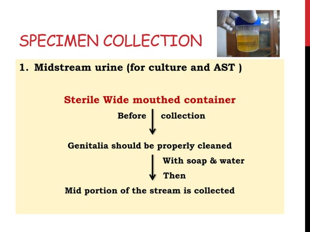 URINE SAMPLE processing.pptx