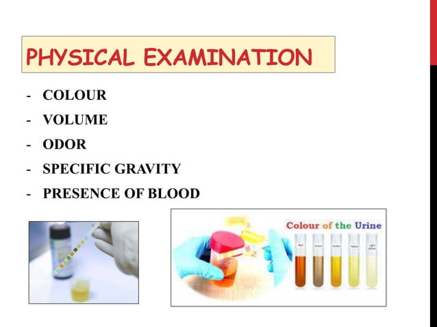 URINE SAMPLE processing.pptx