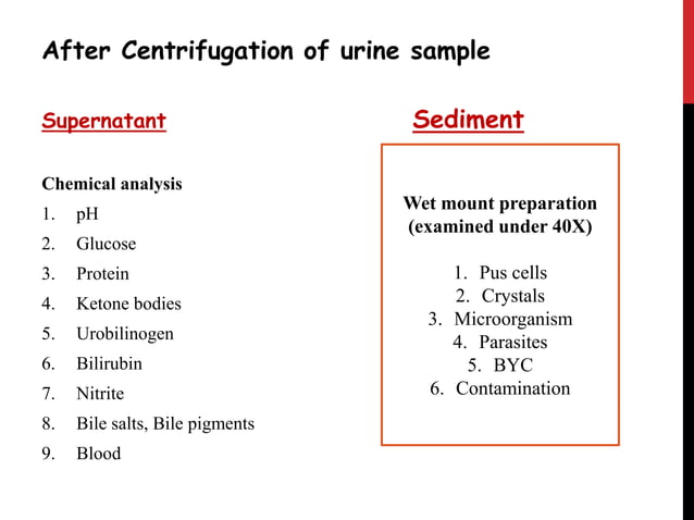 URINE SAMPLE processing.pptx
