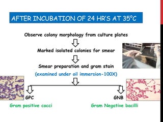 URINE SAMPLE processing.pptx
