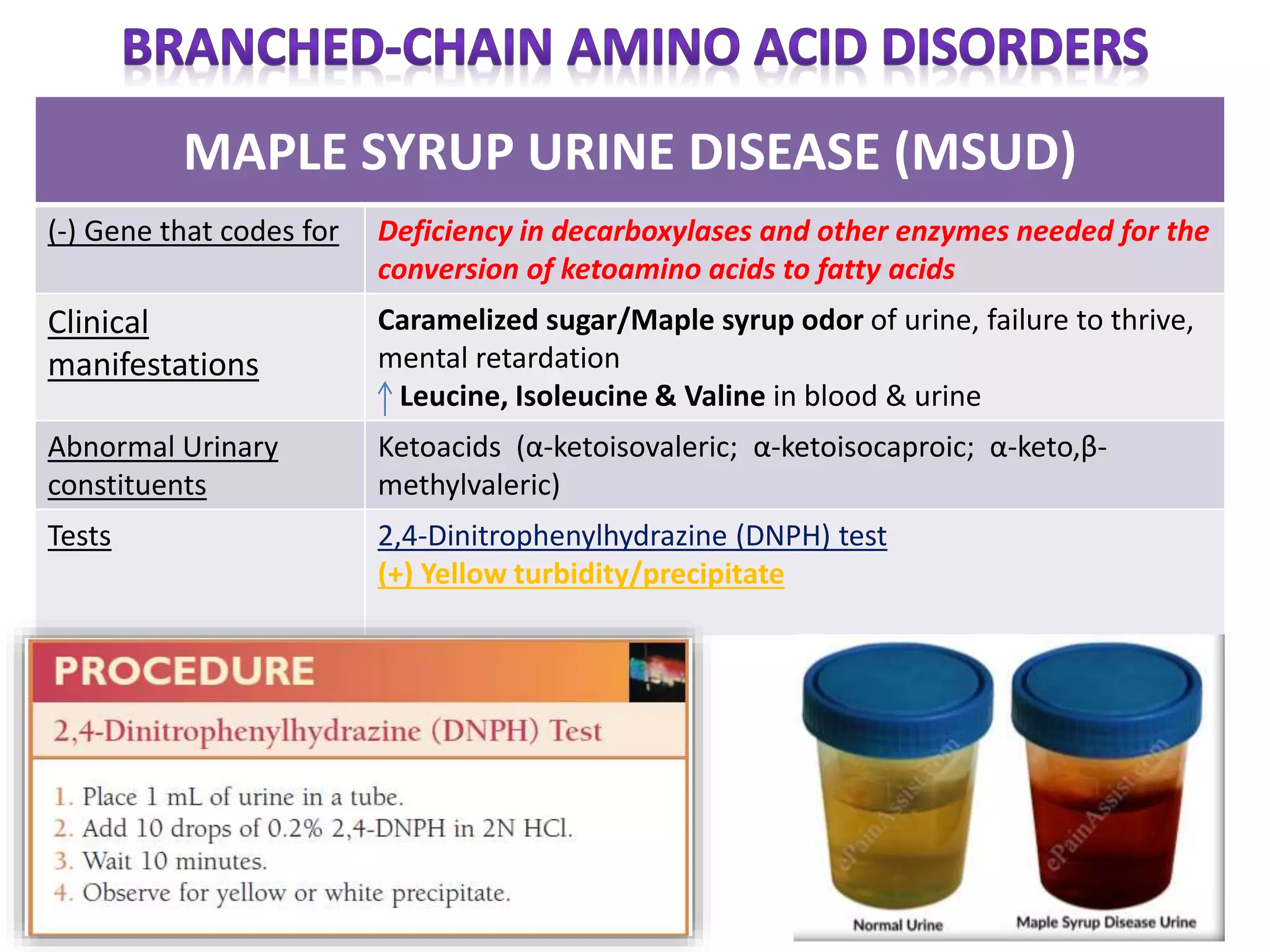 Urine screening for metabolic disorders | PPTX