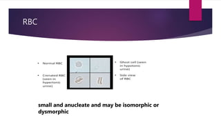 Urine sediment examination in the diagnosis and management | PPTX