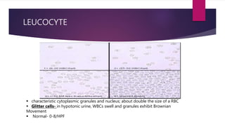 Urine sediment examination in the diagnosis and management | PPTX