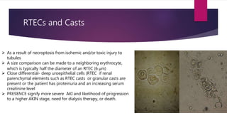 Urine sediment examination in the diagnosis and management | PPTX