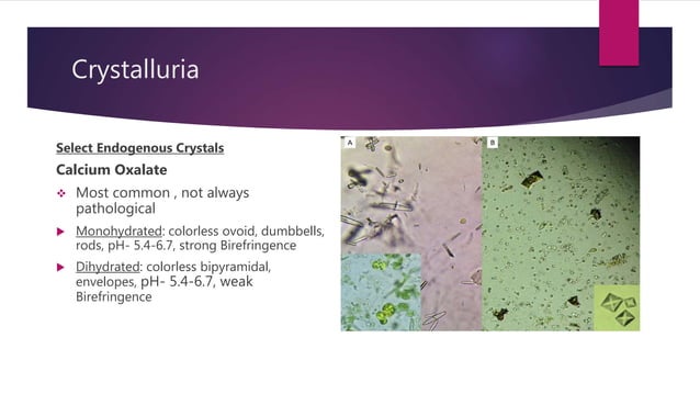 Urine sediment examination in the diagnosis and management | PPTX ...