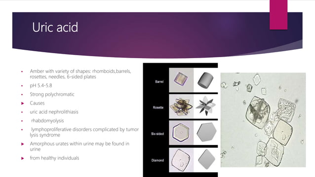 Urine sediment examination in the diagnosis and management | PPTX ...