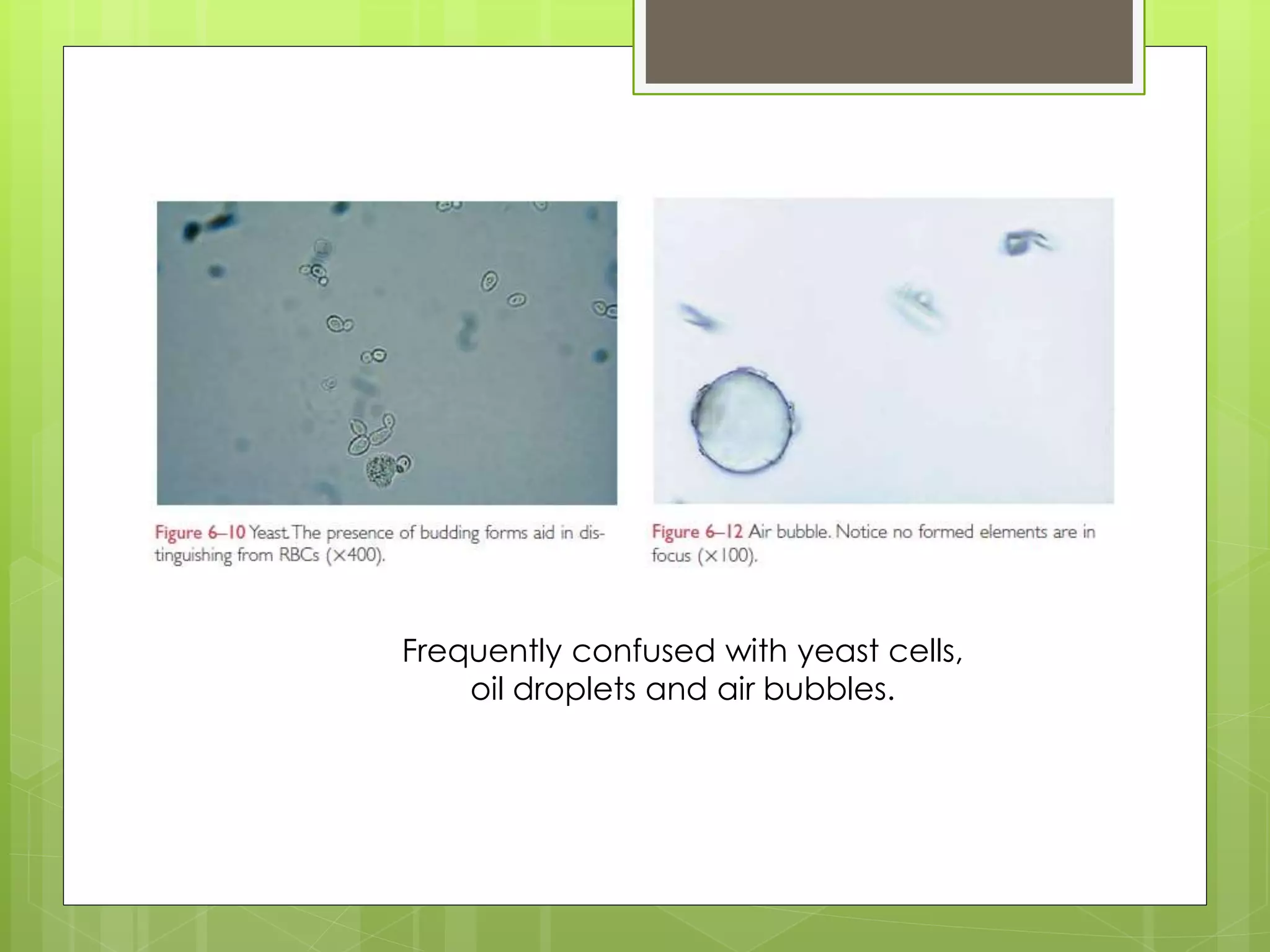 Urine sediments | PPTX