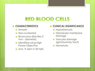Urine sediments | PPTX