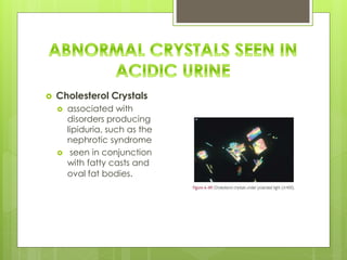 Urine sediments | PPTX