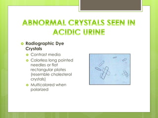 Radiographic Dye Crystals In Urine