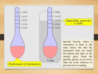 urine test.pptx