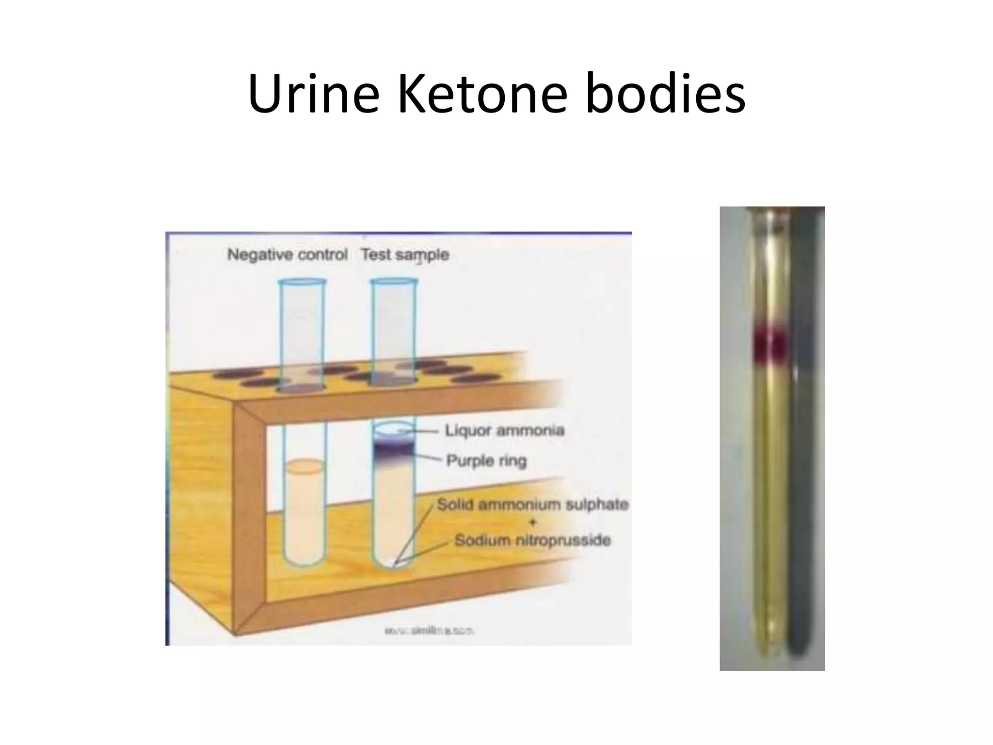 Urine ward Test.pptx