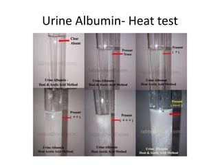 Urine ward Test.pptx