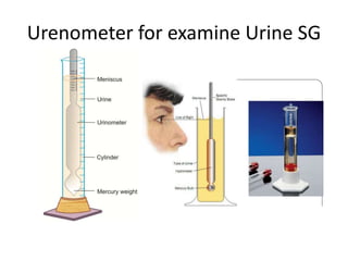 Urine ward Test.pptx