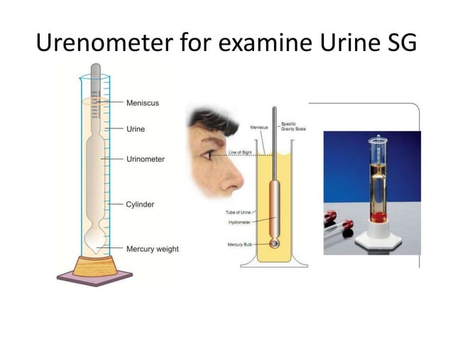 Urine ward Test.pptx