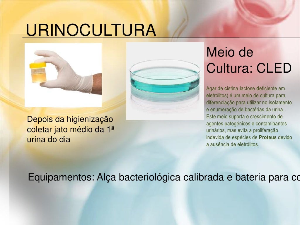 Urinocultura