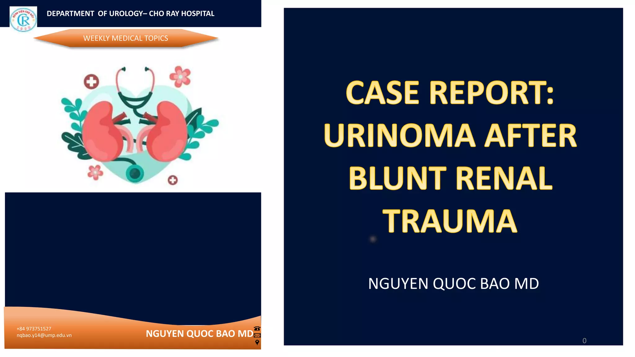Managing a Large Urinoma After Renal Trauma | PPT