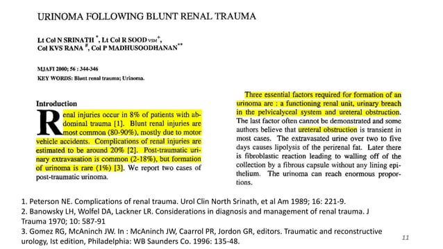 Urinoma after renal trauma (1).pptx