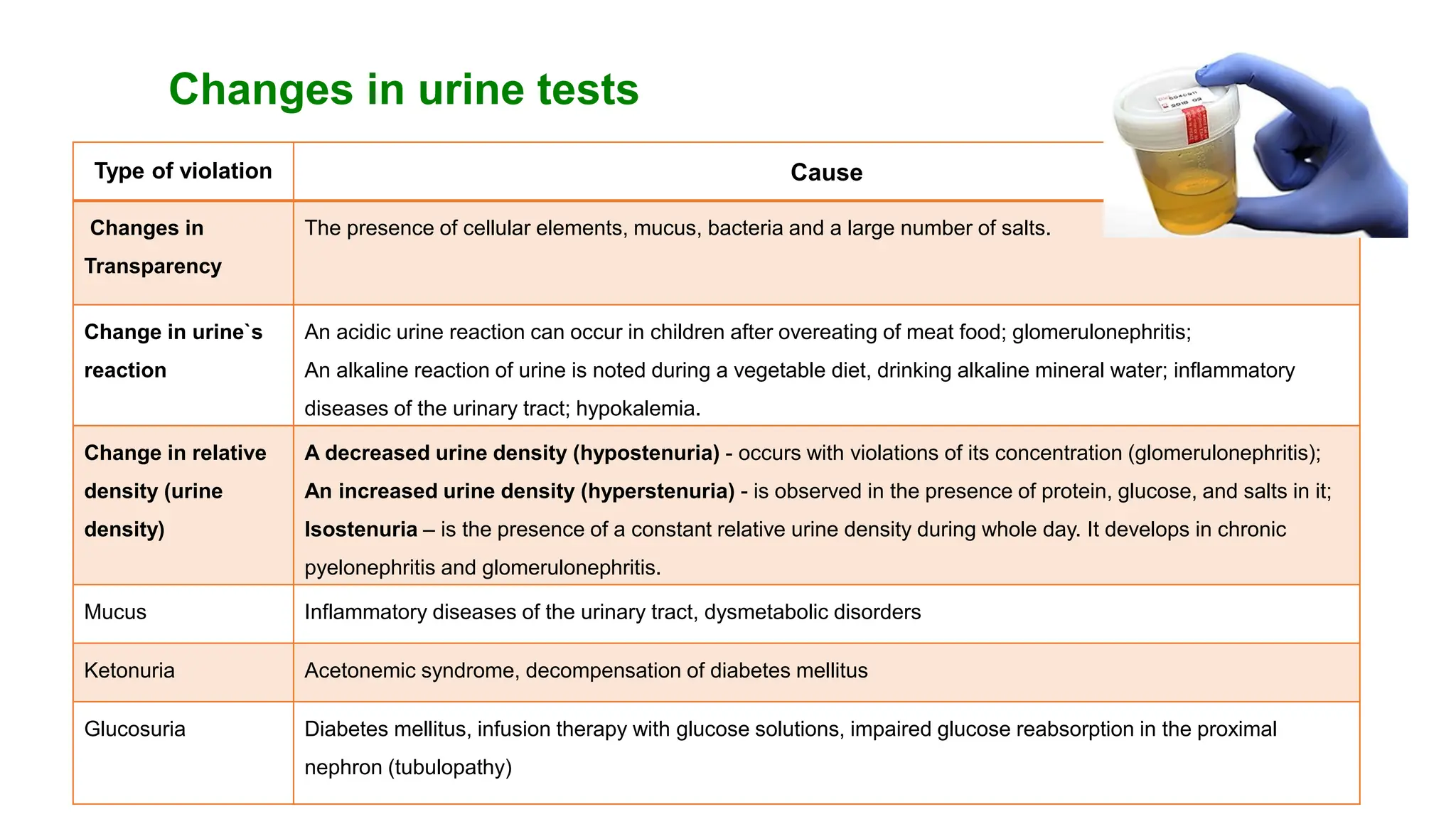 UrinSyndr_Lect#1_zoom+.pdfof urinary tract | PDF | Medical Health
