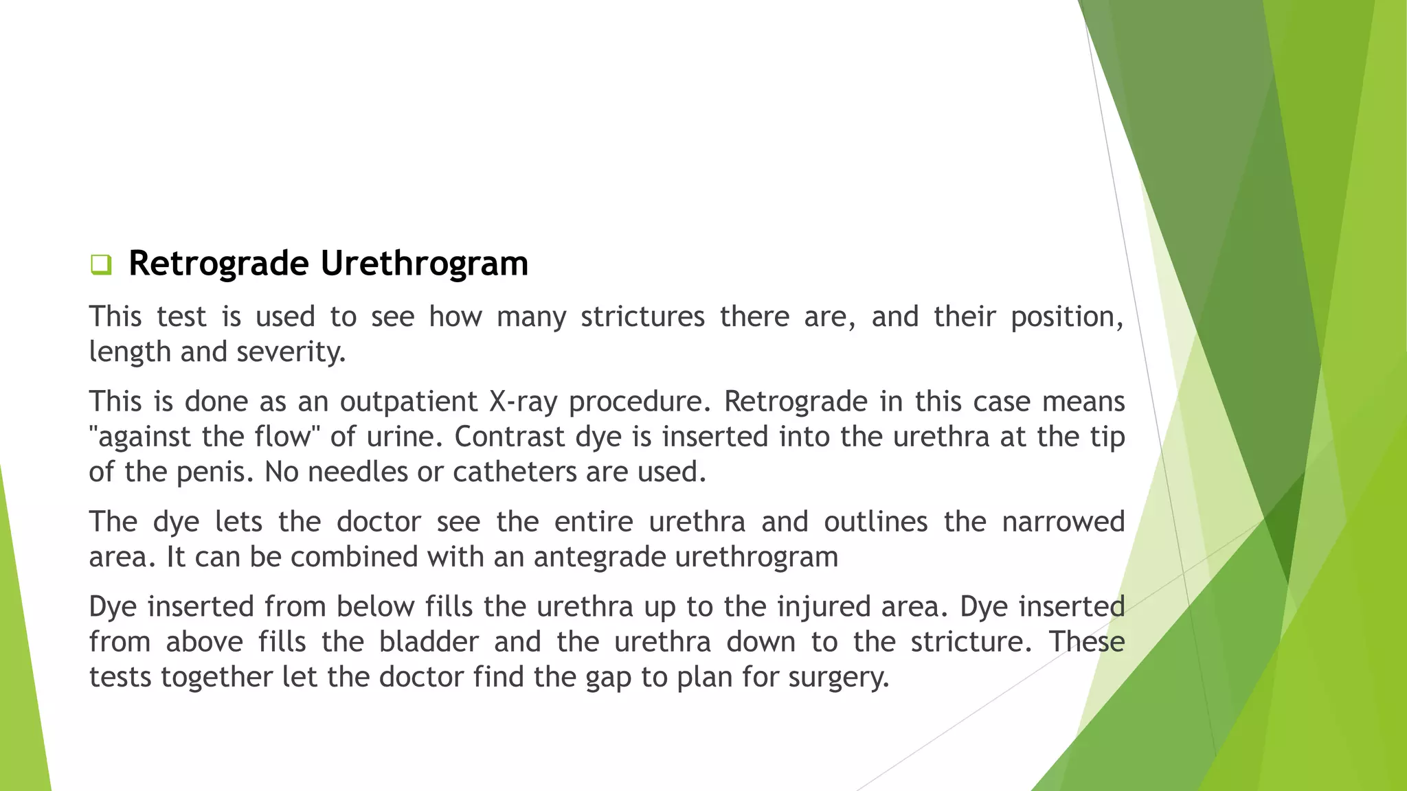 Urethral stricture | PPTX