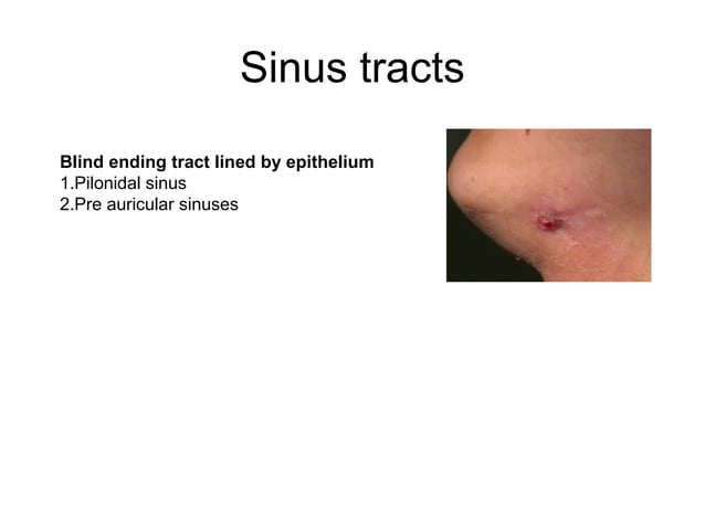 Abcess+incision+and+drainage | PPT | Ear, Nose and Throat Conditions ...