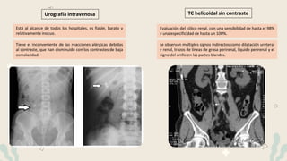 urolitiasis_cálculo renal:COLICO RENAL, HEMATURIA Y RAO.pptx
