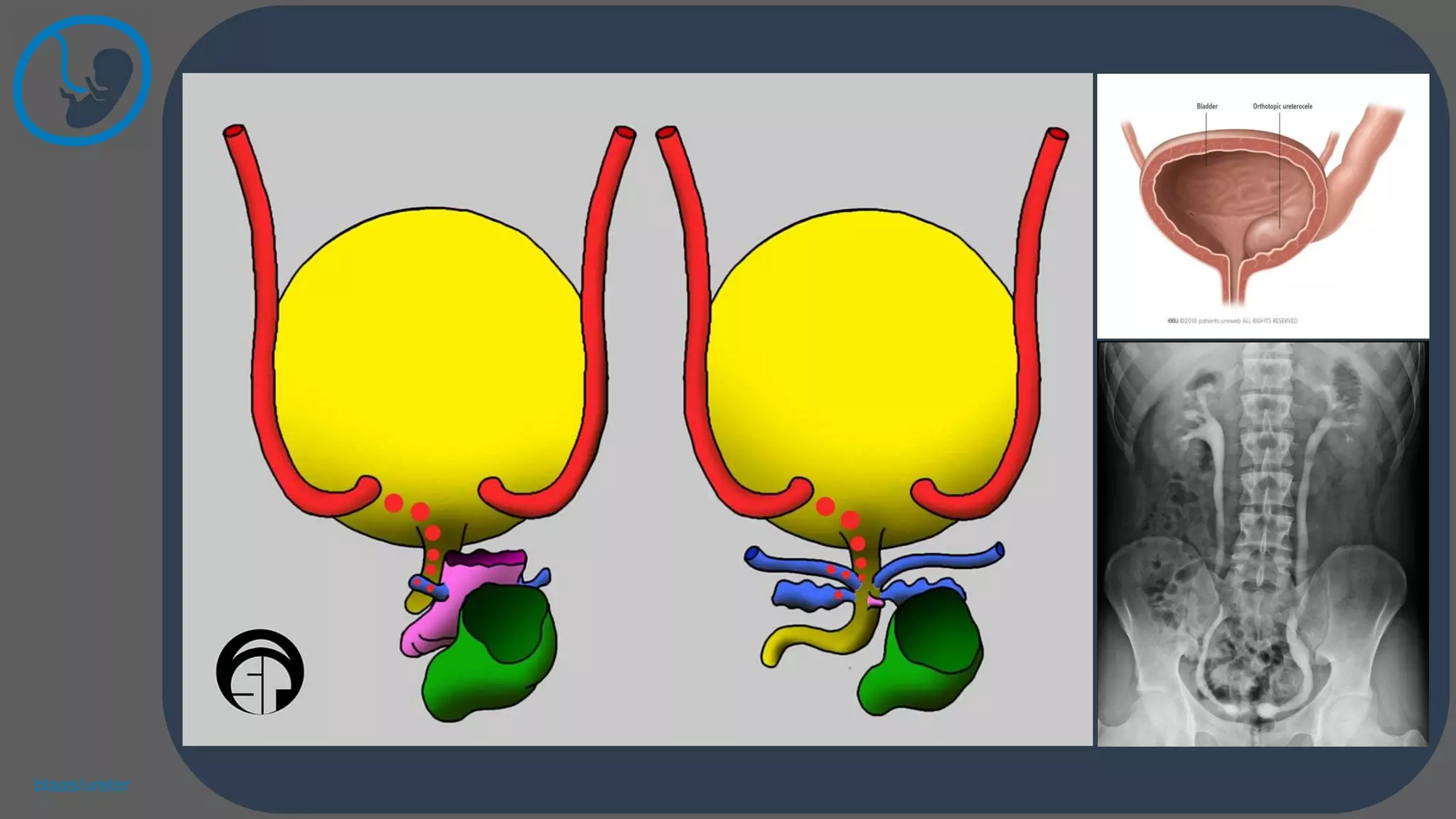 Embryologie van het urogenitale stelsel | PPT