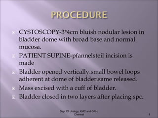 Uro gynaecology- bladder endometriosis | PDF