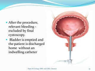 Uro gynacology- botox | PDF