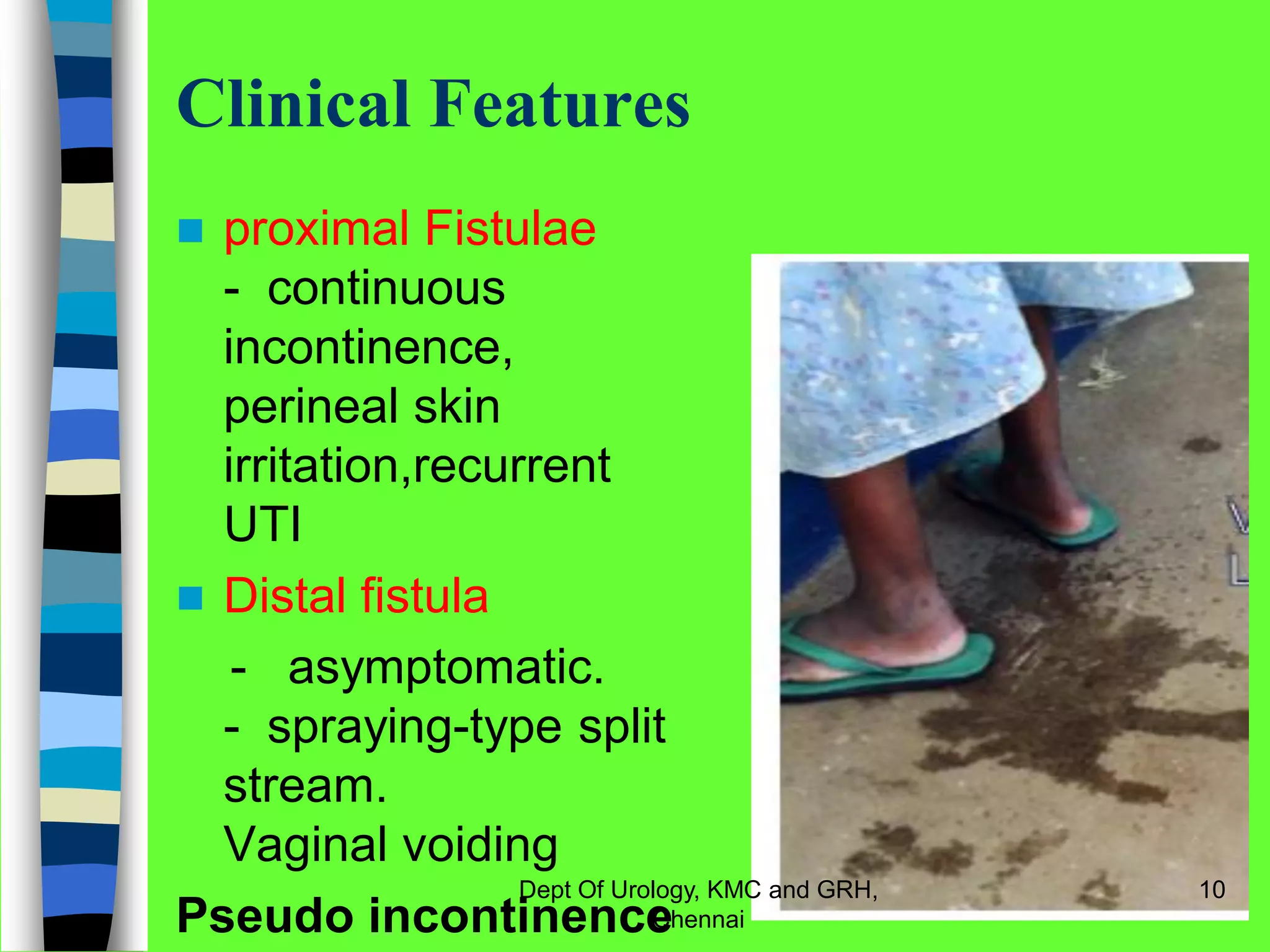 Uro gynacology- urethrovaginal f. | PPT