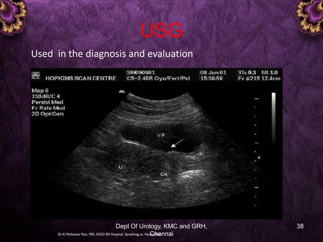Uro gynacology- vef | PPT