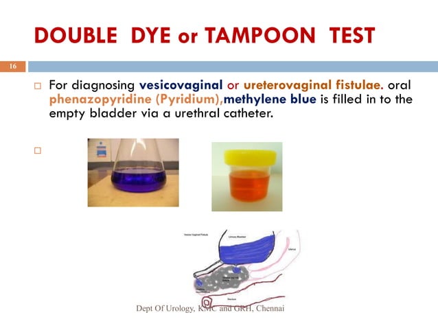 Uro gynacology- vvf | PDF | Sexual Conditions | Sexual Health