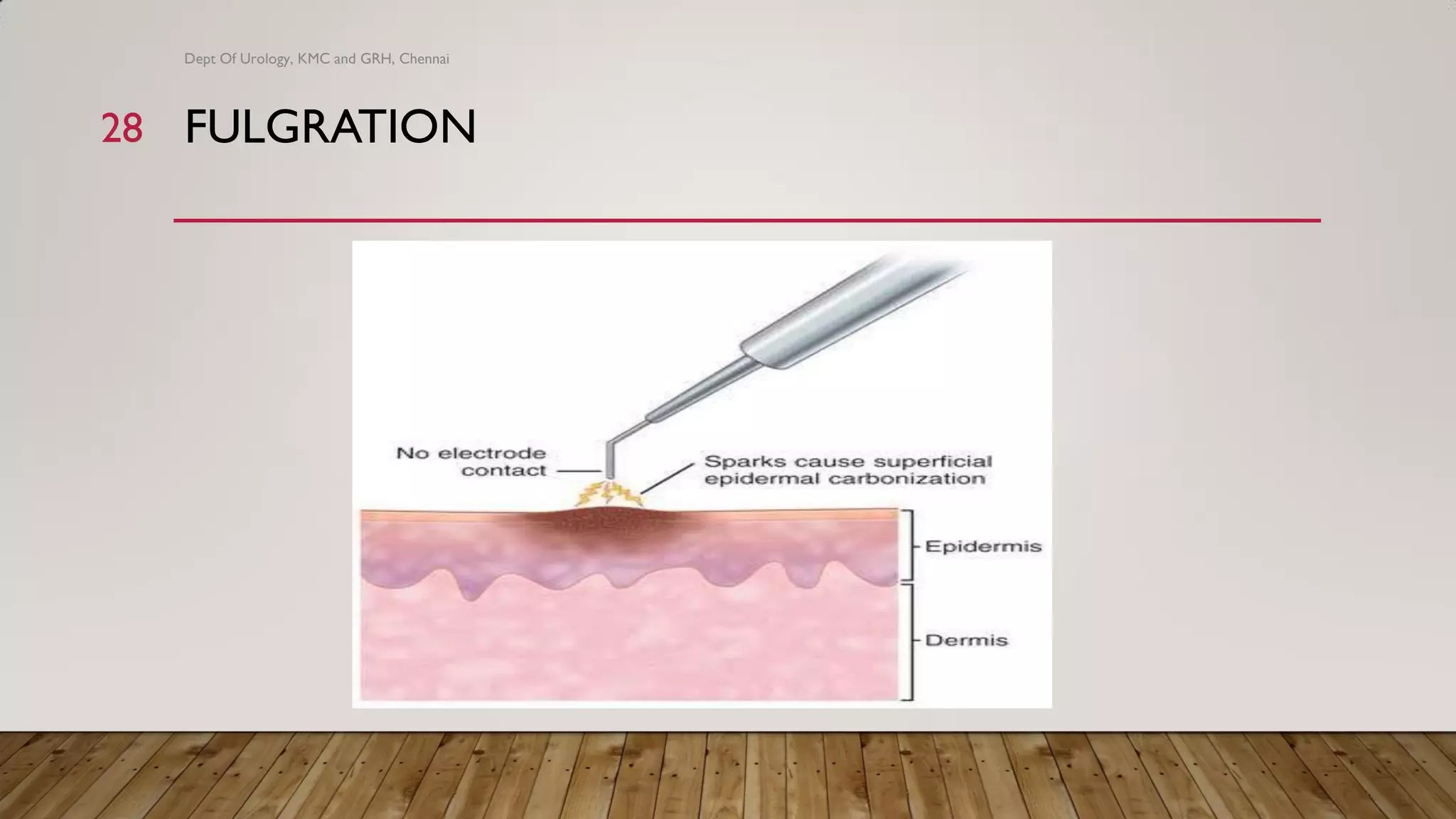 Uro instruments- electrosurgery | PDF | First Aid | Injuries