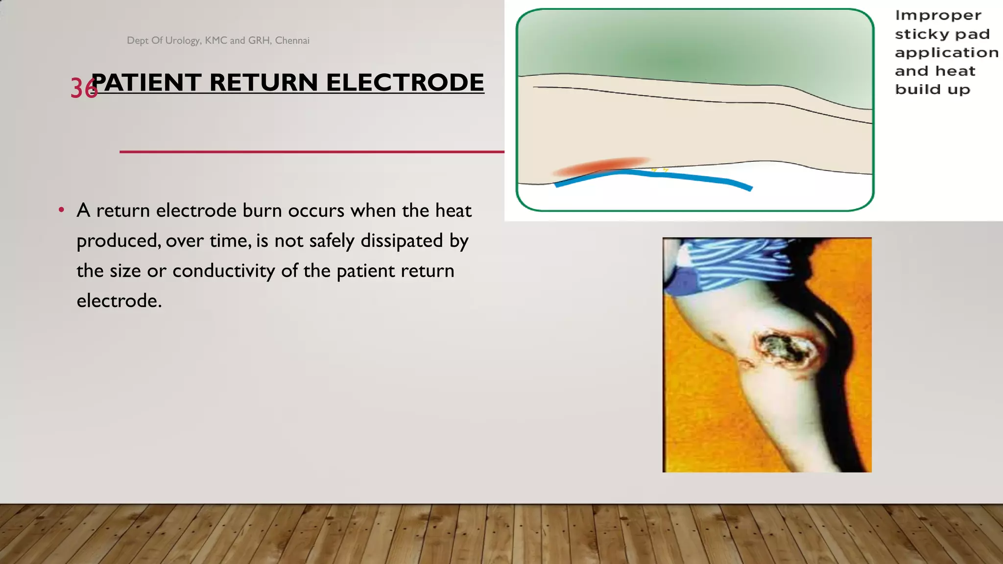 Uro instruments- electrosurgery | PDF | First Aid | Injuries