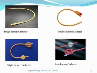 Triple Lumen Urinary Catheter