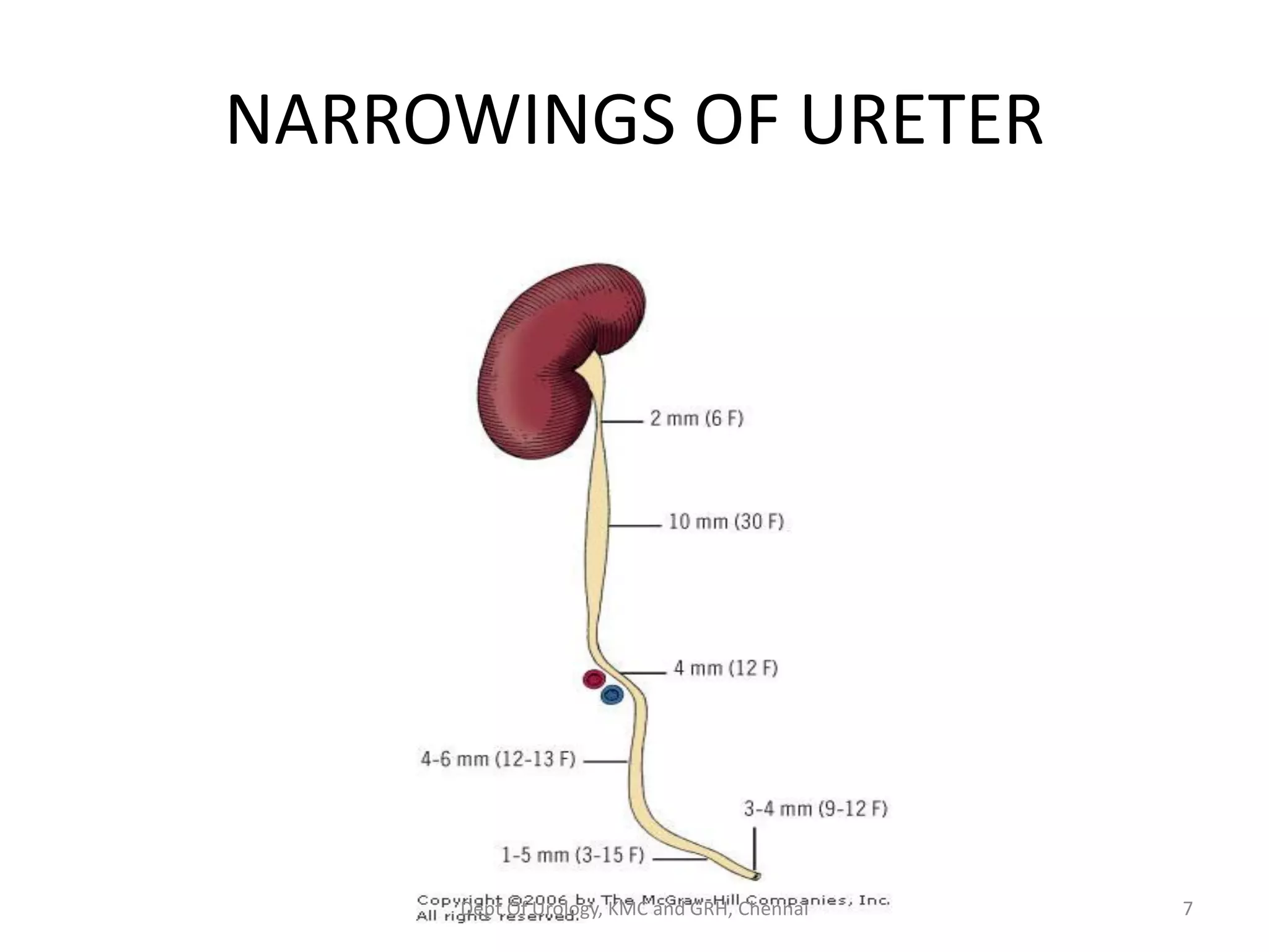 Uro instruments- upper tract | PDF