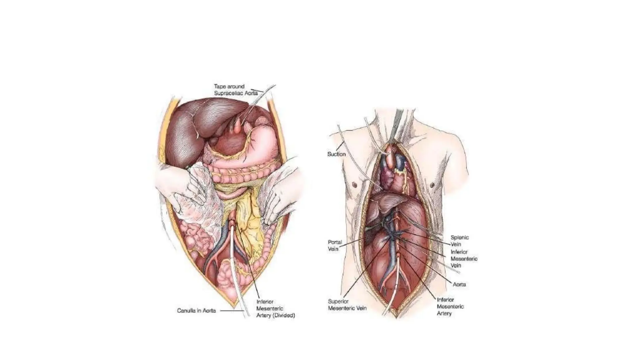 Uro- nephro - Deceased kidney donor evaluation.pdf