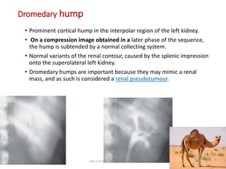 INTRAVENOUS UROGRAPHY | PPT