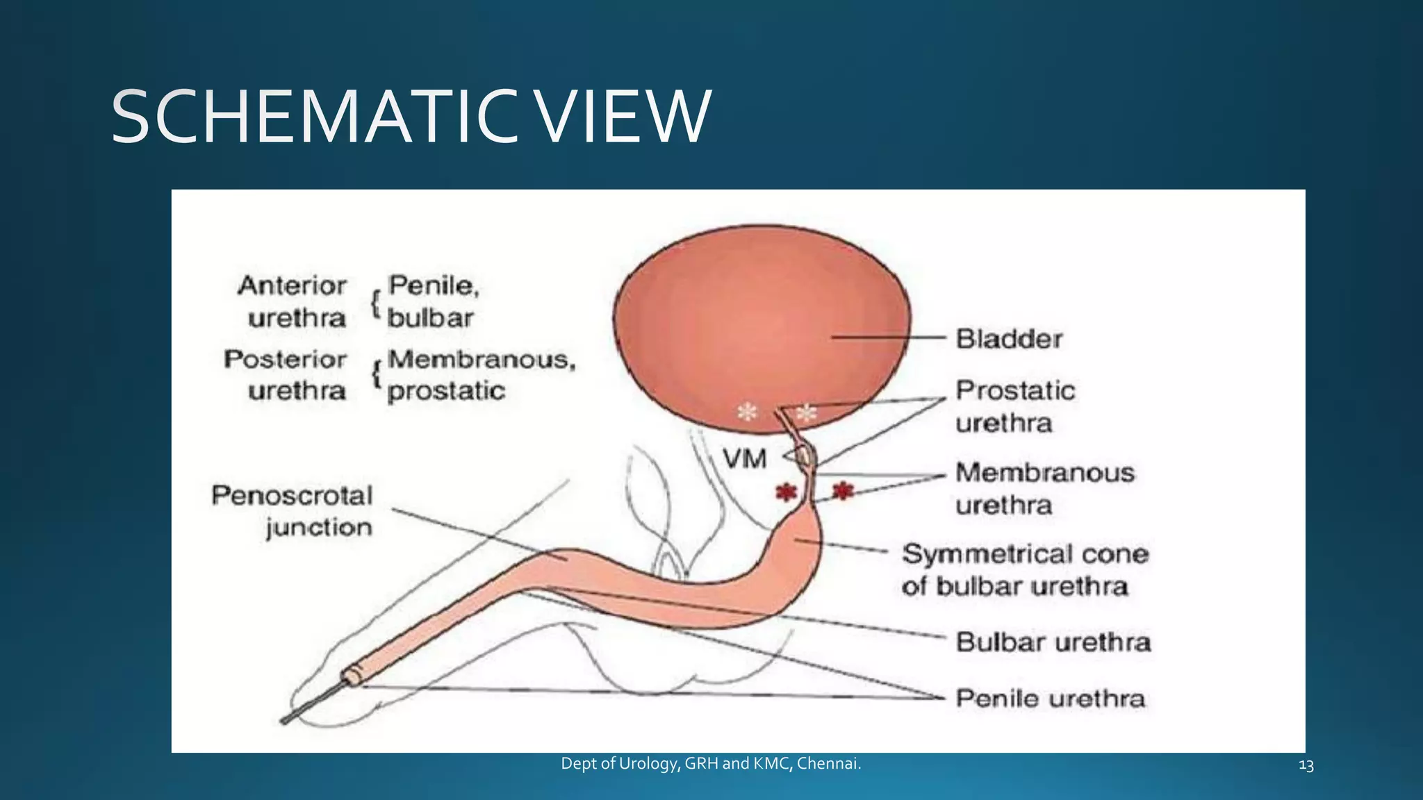 ANTEGRADE URETHROGRAM | PDF