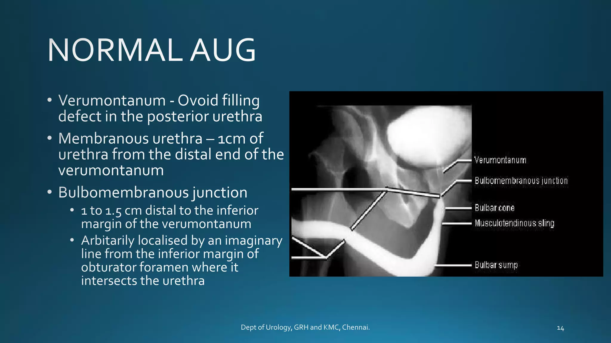 ANTEGRADE URETHROGRAM | PDF