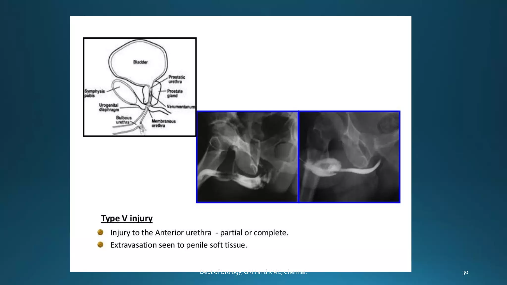 ANTEGRADE URETHROGRAM | PDF