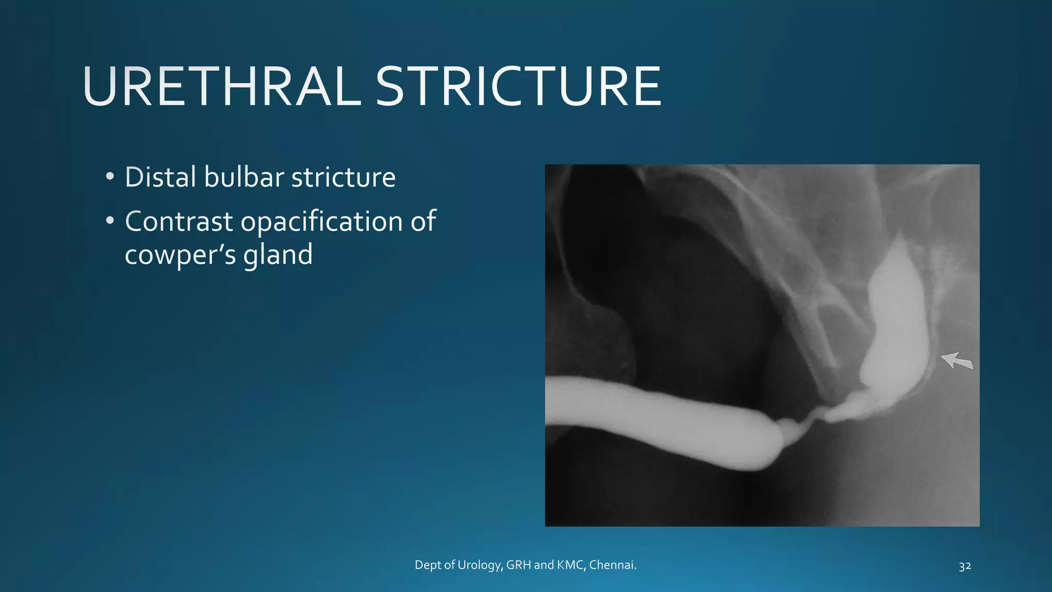 ANTEGRADE URETHROGRAM | PDF