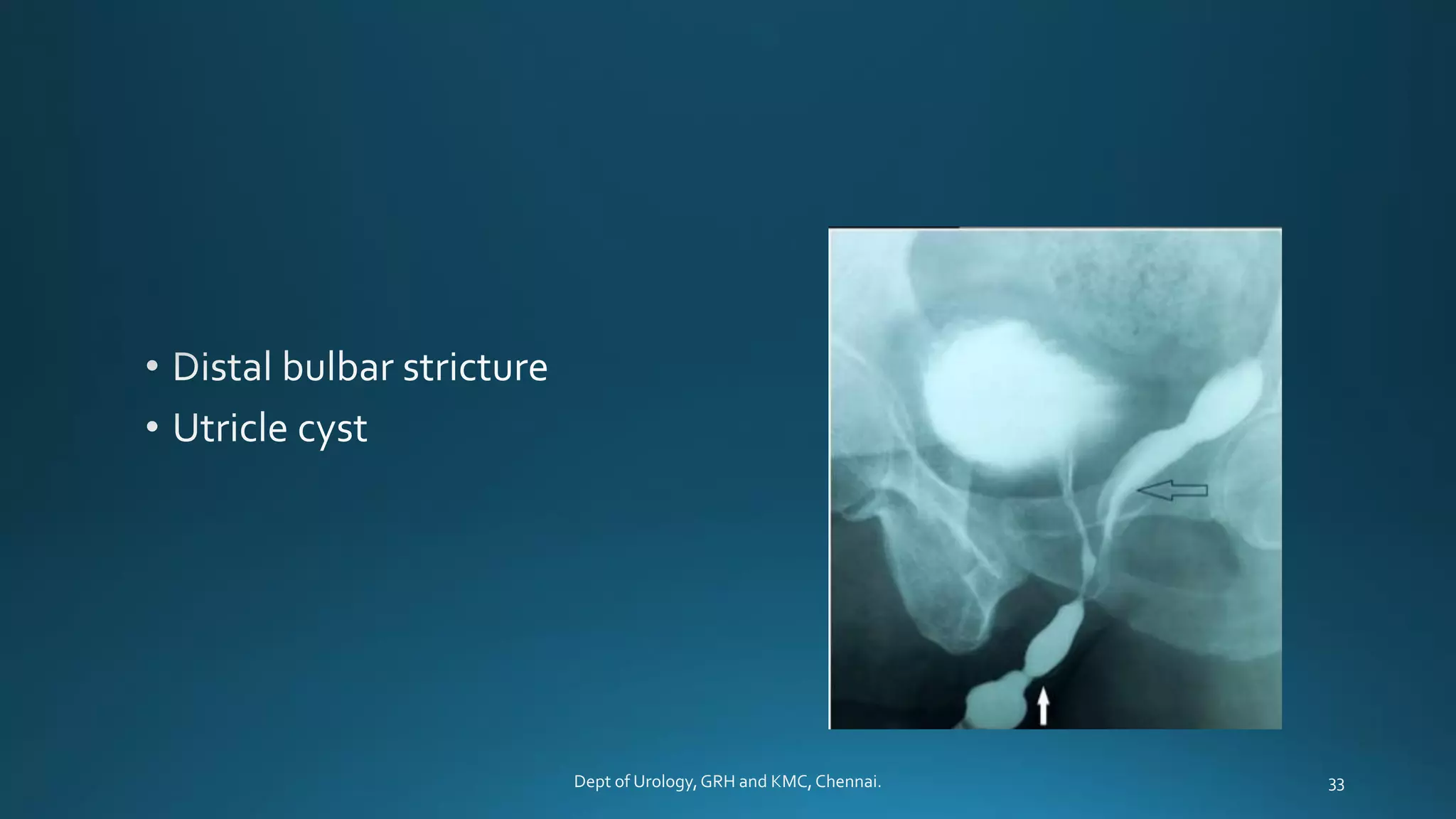 ANTEGRADE URETHROGRAM | PDF