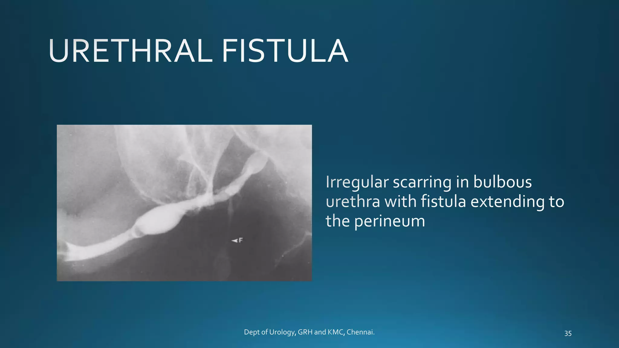 ANTEGRADE URETHROGRAM | PDF