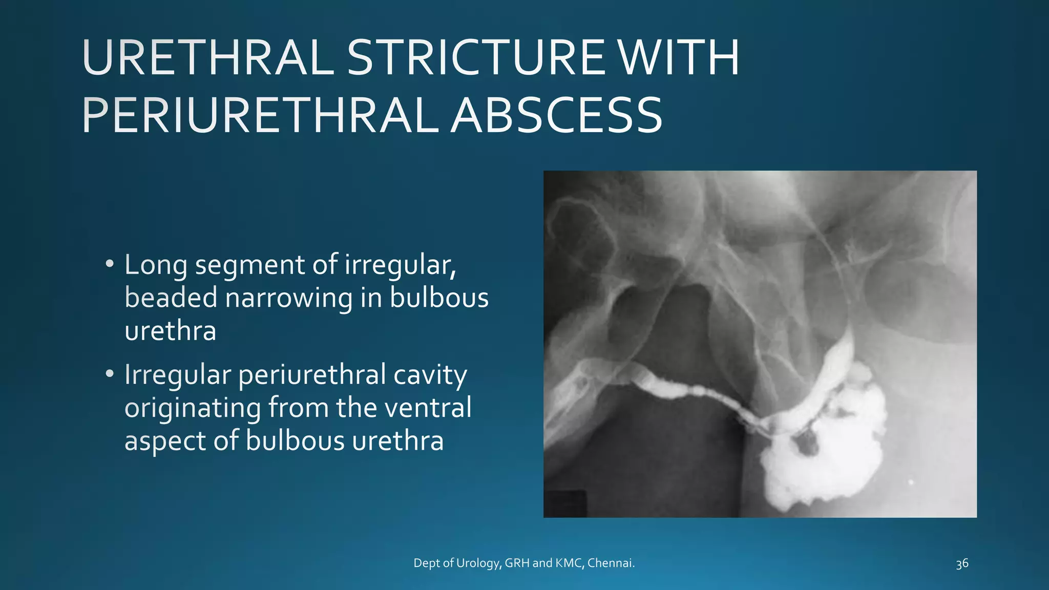 ANTEGRADE URETHROGRAM | PDF