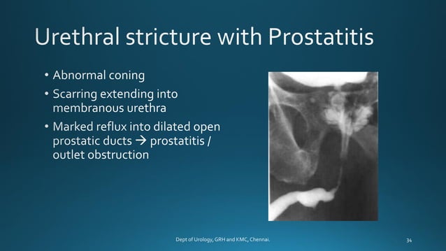 ANTEGRADE URETHROGRAM | PDF | Sexual Conditions | Sexual Health