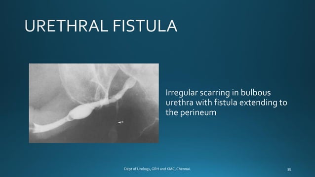 ANTEGRADE URETHROGRAM | PDF